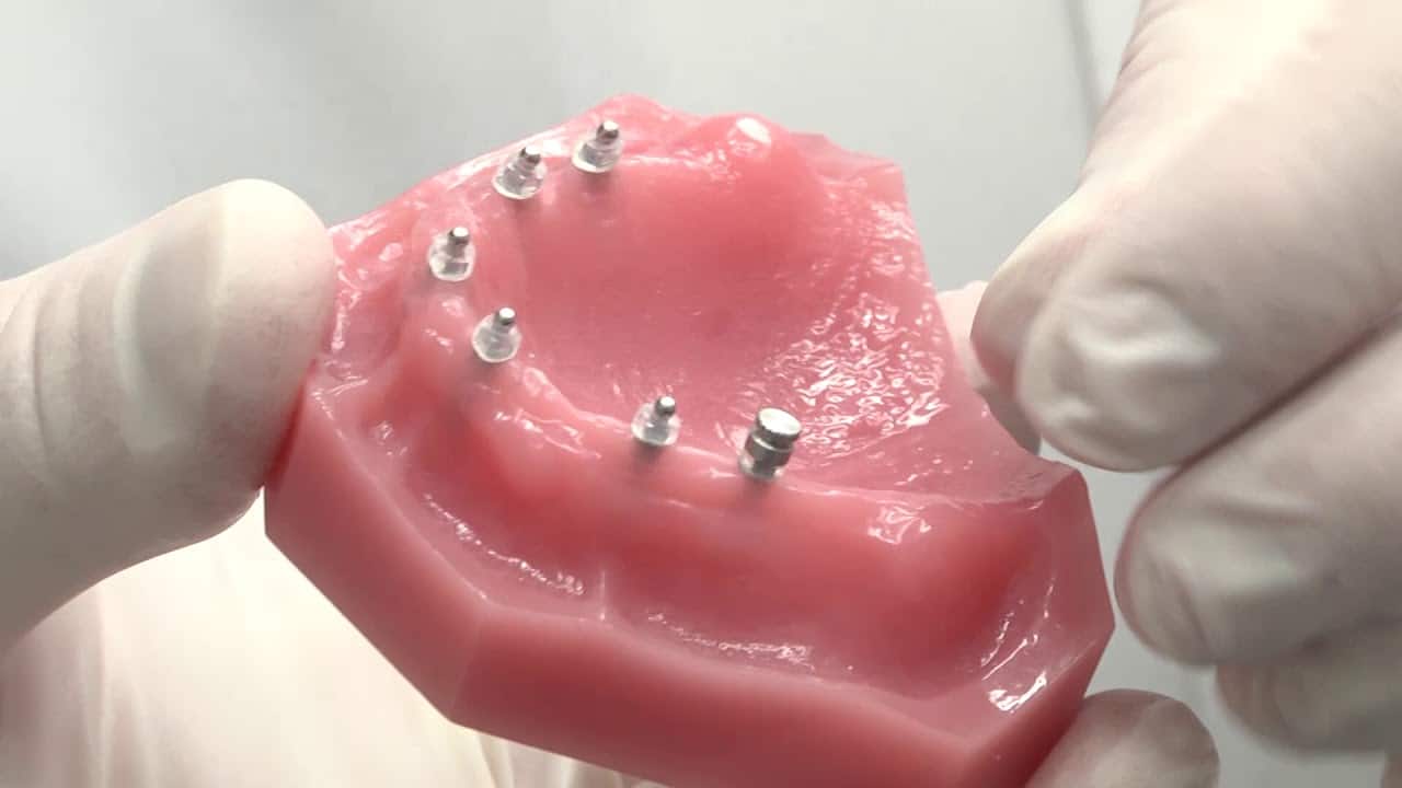 A Simple, Cost Effective Alternative to All on 4 - Fix on Six