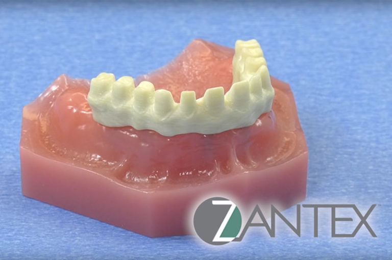 Zantex™ the newest metal-free suprastructure material
